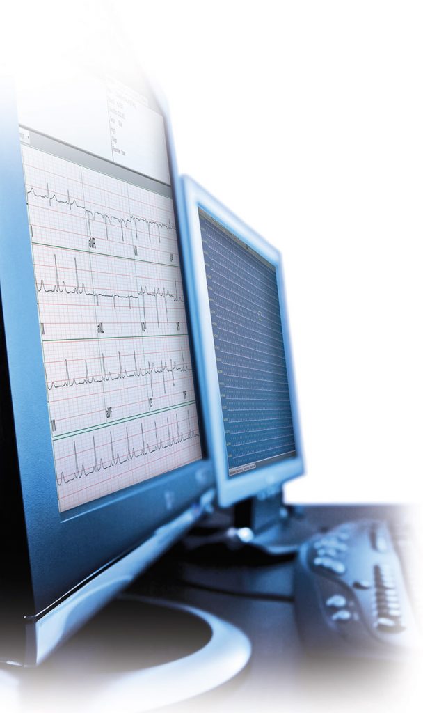 Holter Monitoring Archives - Ecomed