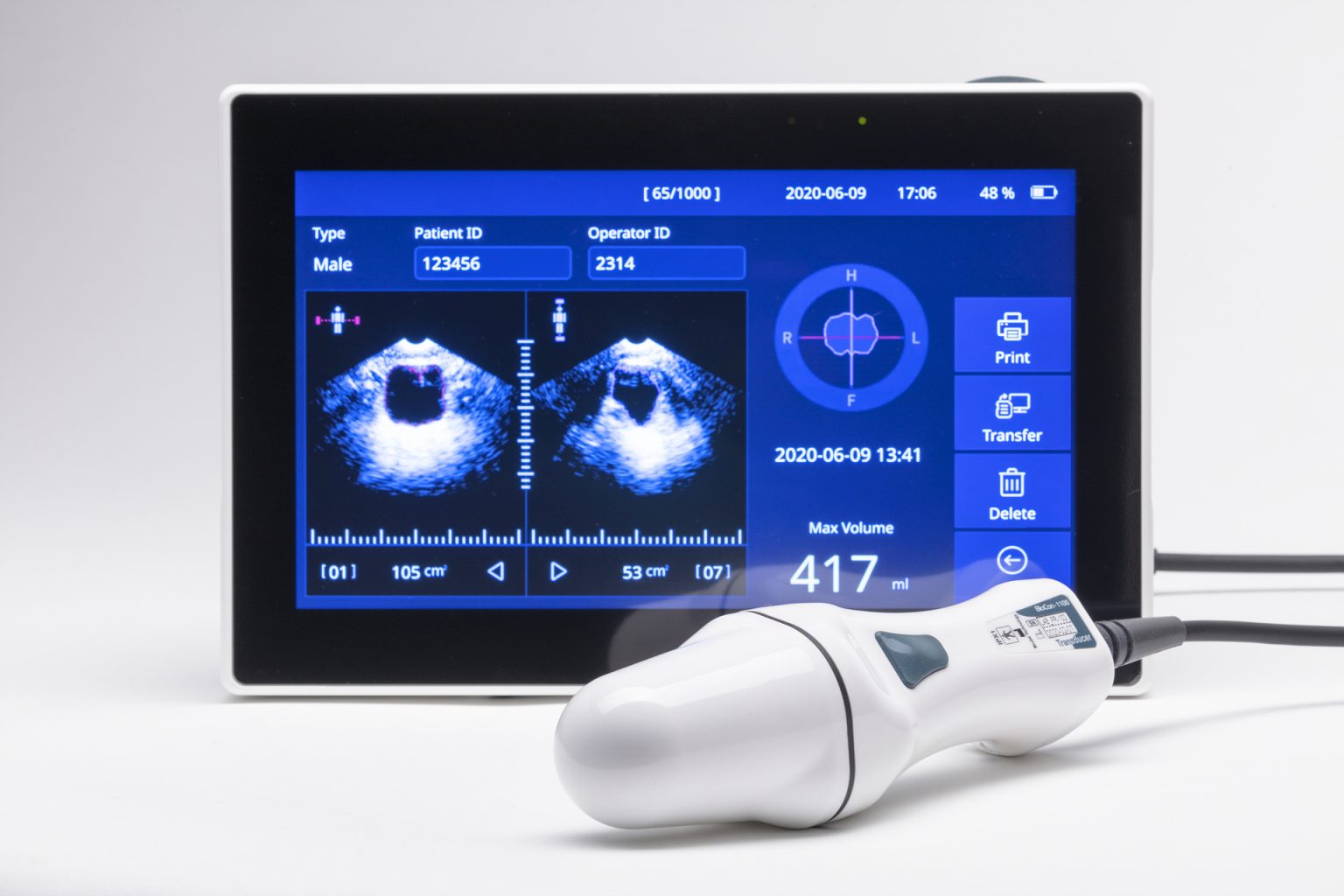 Mcube BioCon-1100 Bladder Scanner - Ecomed